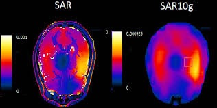 Seminar “Machine Learning in MRI” › MR-Physik am Universitätsklinikum ...
