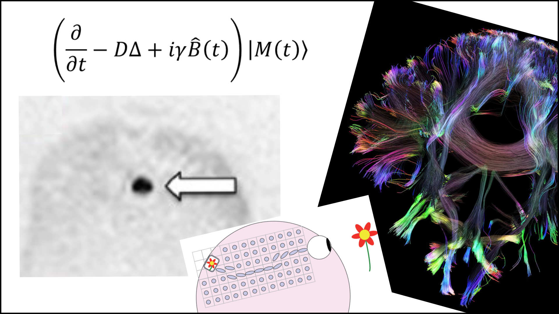 MR-Physik an der FAU und dem UKER - Neue Methoden für die Radiologie ... MR-Physik an der FAU und dem UKER - Neue Methoden für die Radiologie ...