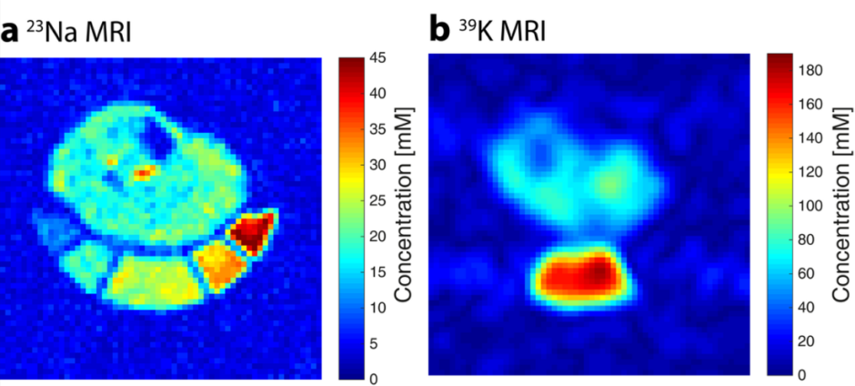 xMRI Lab (Nagel) - MRT-Forschung am Universitätsklinikum Erlangen