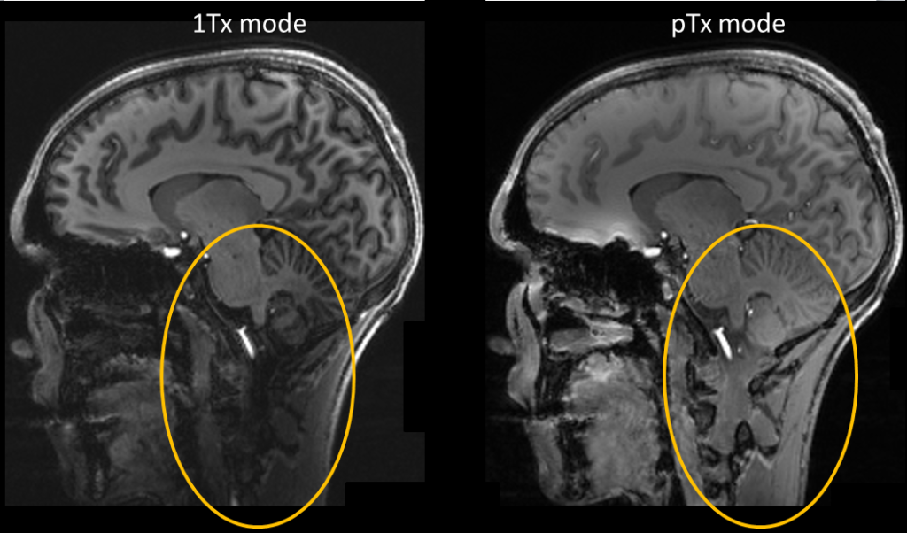 xMRI Lab (Nagel) - MRT-Forschung am Universitätsklinikum Erlangen