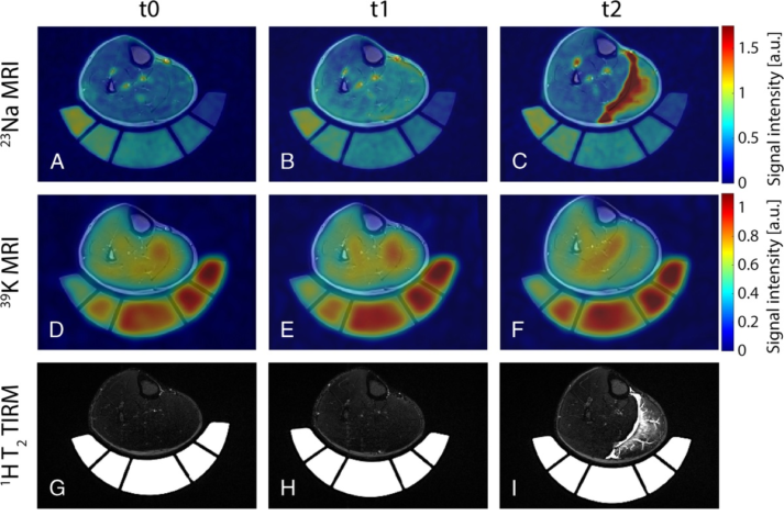 Neues Papier: MRI of Potassium and Sodium Enables Comprehensive ...
