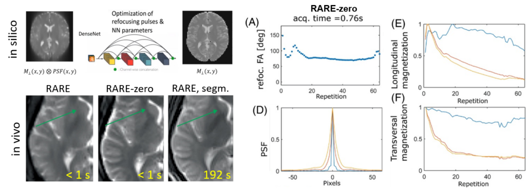 New paper: MR-zero meets RARE MRI: Joint optimization of refocusing ...