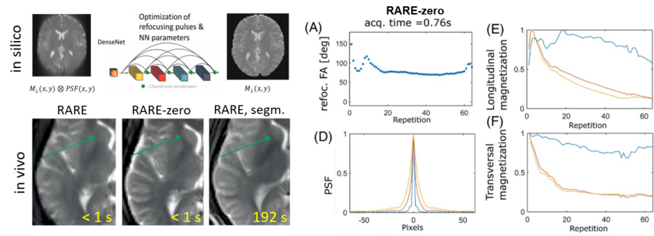 New paper: MR-zero meets RARE MRI: Joint optimization of refocusing flip angles and neural ...